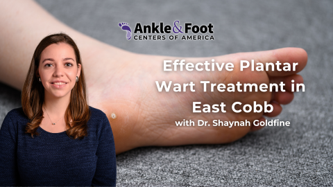 Effective Plantar Wart Treatment in East Cobb